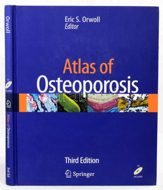 Eric S. Orwoll (szerk.): Atlas of osteoporosis. Philadelphia, 2009 ...